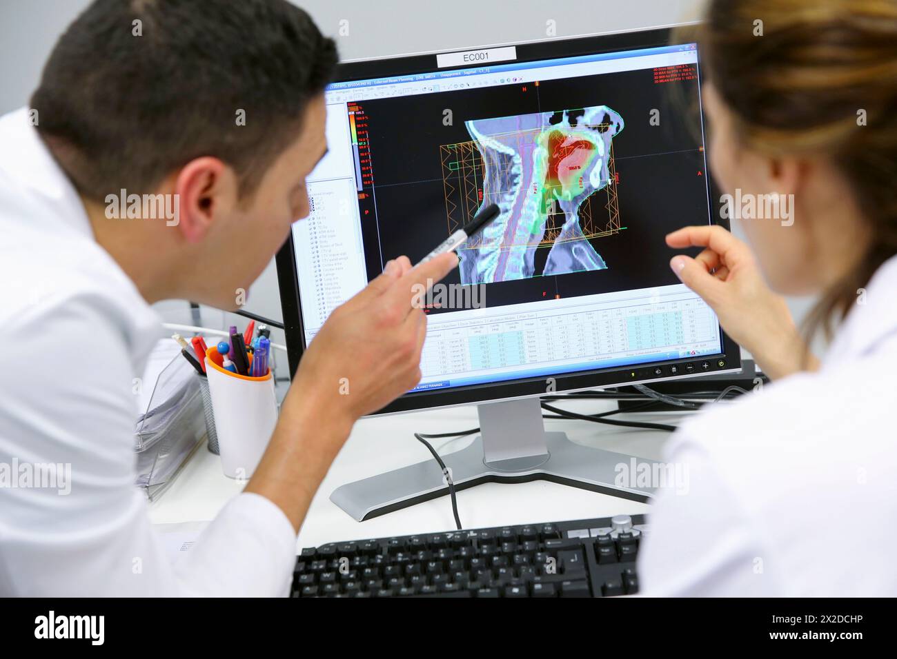IMRT, Intensity Modulated Radiation Therapy, Oropharynx Cancer 3D ...