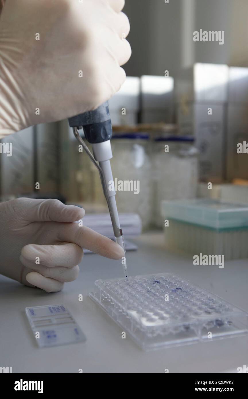 Taking samples in 96-Well tissue culture dish with micropipette ...