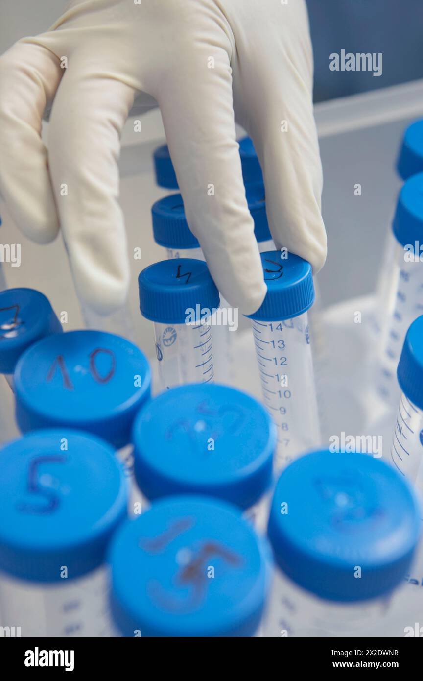 Biological samples. Quarantine zone (Grade C), clean room. Laboratory ...