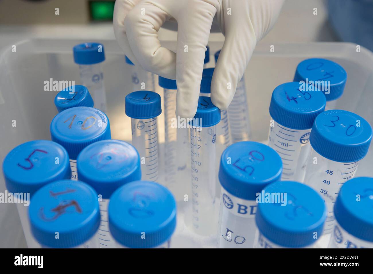 Biological samples. Quarantine zone (Grade C), clean room. Laboratory ...