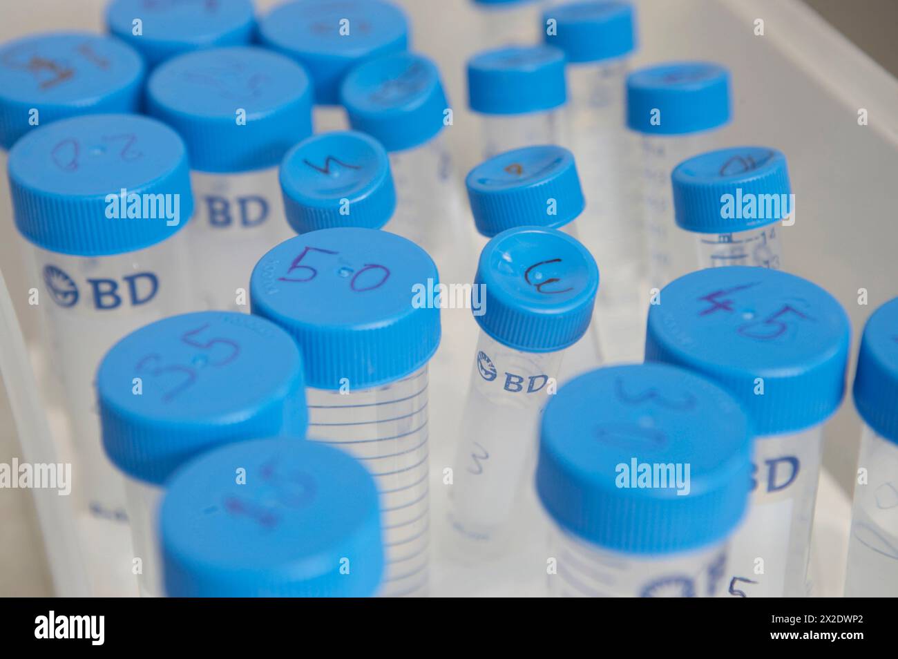 Biological samples. Quarantine zone (Grade C), clean room. Laboratory ...