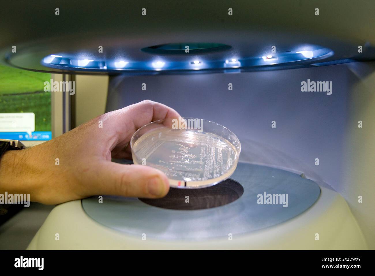 Colony Counter. Biopharmaceutical lab, development of new therapeutic ...