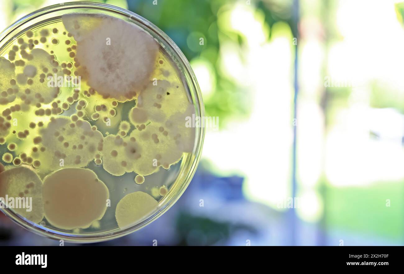 Mould test petri dish culture medium with spore colonies for measuring ...