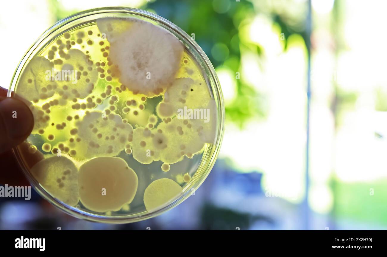 Mould test petri dish culture medium with spore colonies for measuring ...