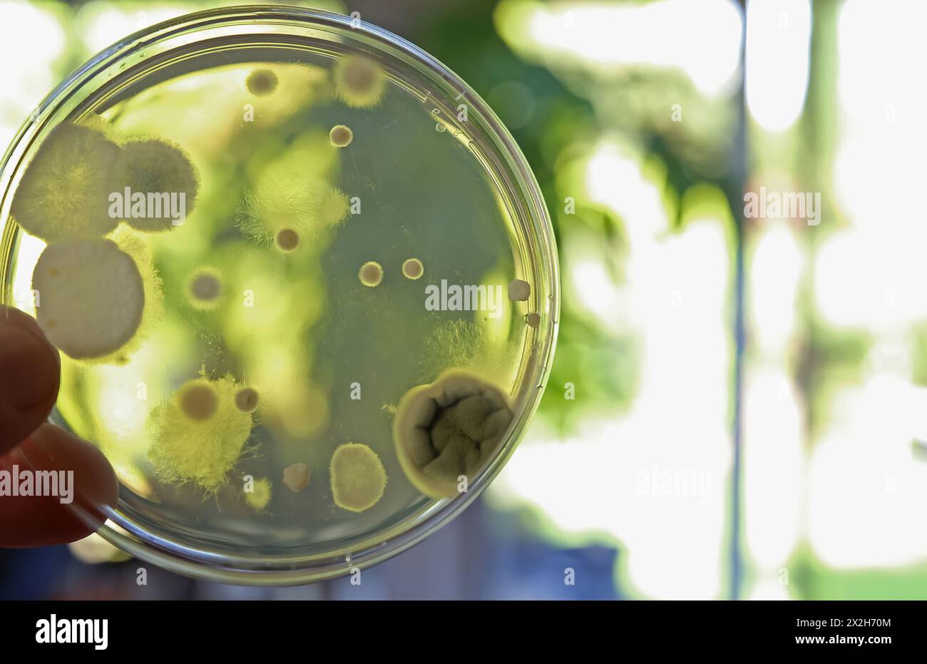 Mould test petri dish culture medium with spore colonies for measuring ...