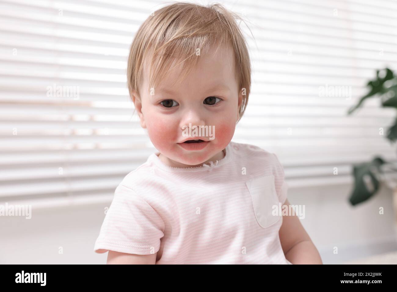 Red cheeks ill child hi-res stock photography and images - Alamy