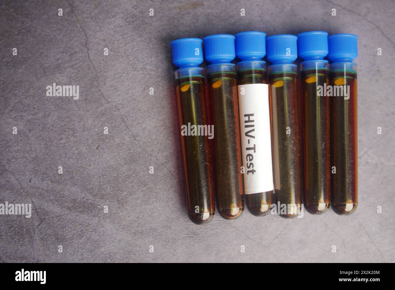HIV blood test tube on black background Stock Photo - Alamy