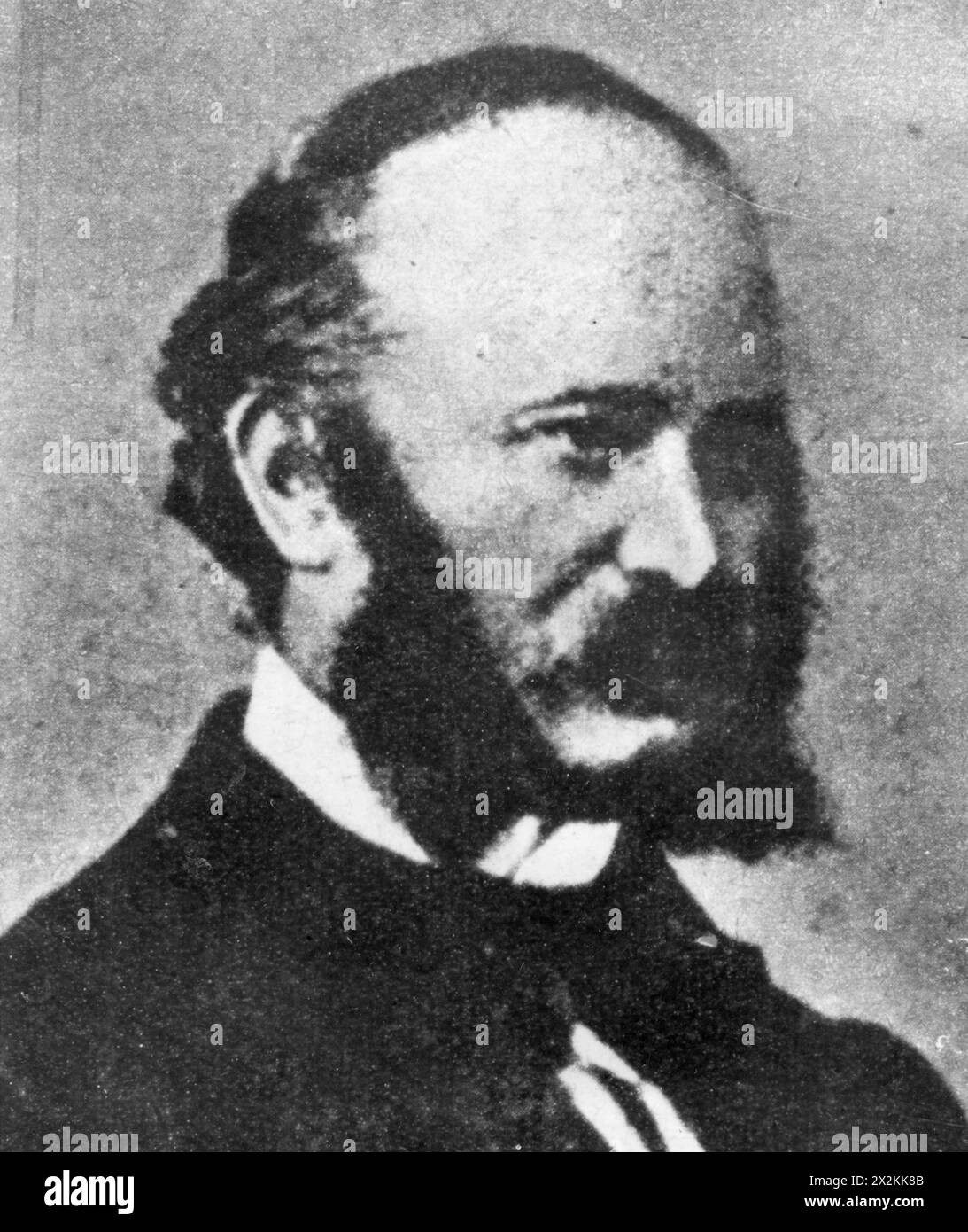 Premium operative removing a kidney 1869 hi-res stock photography and ...