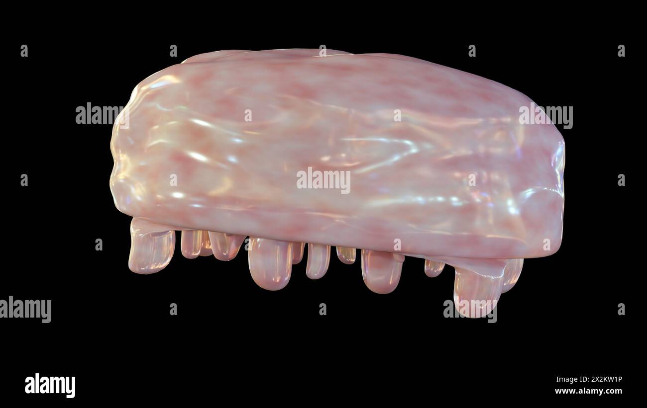 3d rendering of Osteoclasts, are the cells that degrade bone to ...