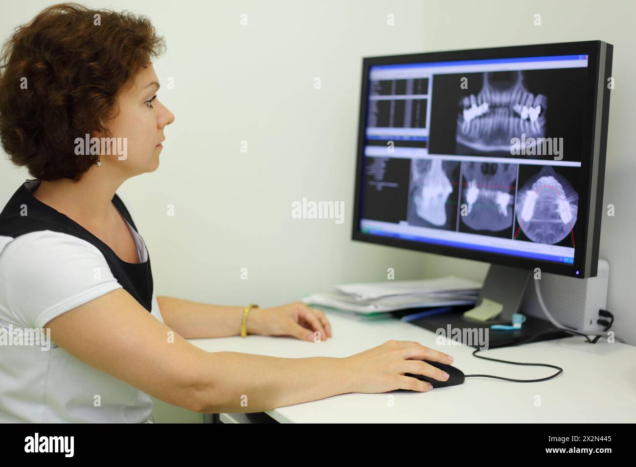 Dentist carefully looks jaw X-rays at computer monitor in dental clinic ...