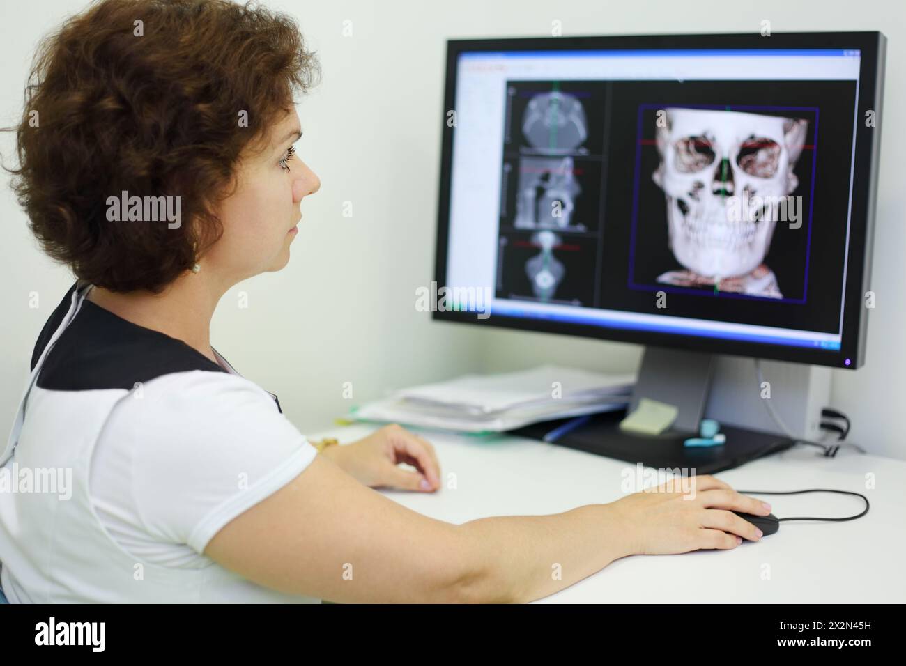 Dentist carefully looks jaw and skull X-rays at computer monitor in ...