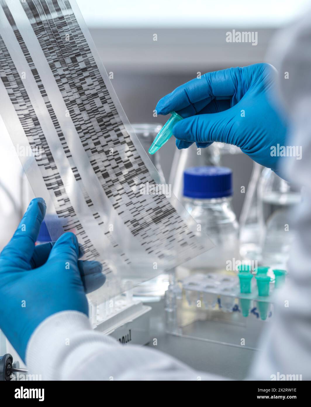 Scientist analyzing DNA electrophoresis data in laboratory Stock Photo ...