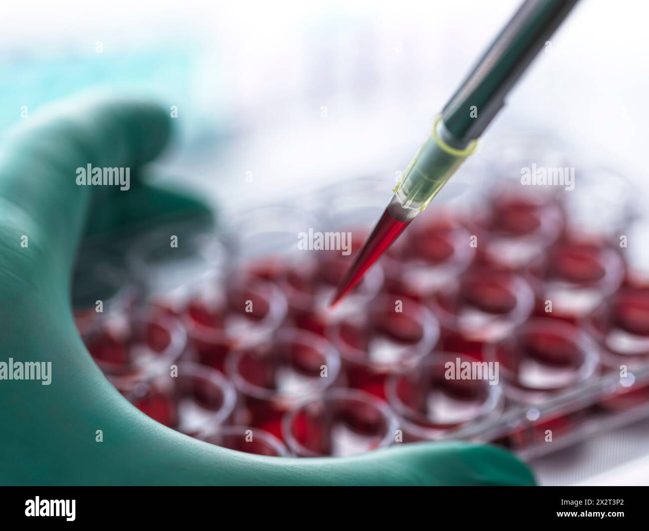 Laboratory analysis red blood cell hi-res stock photography and images ...