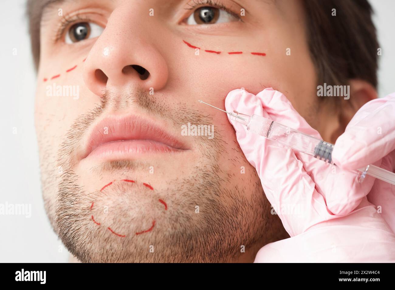 Young man with marked face receiving injection on light background ...