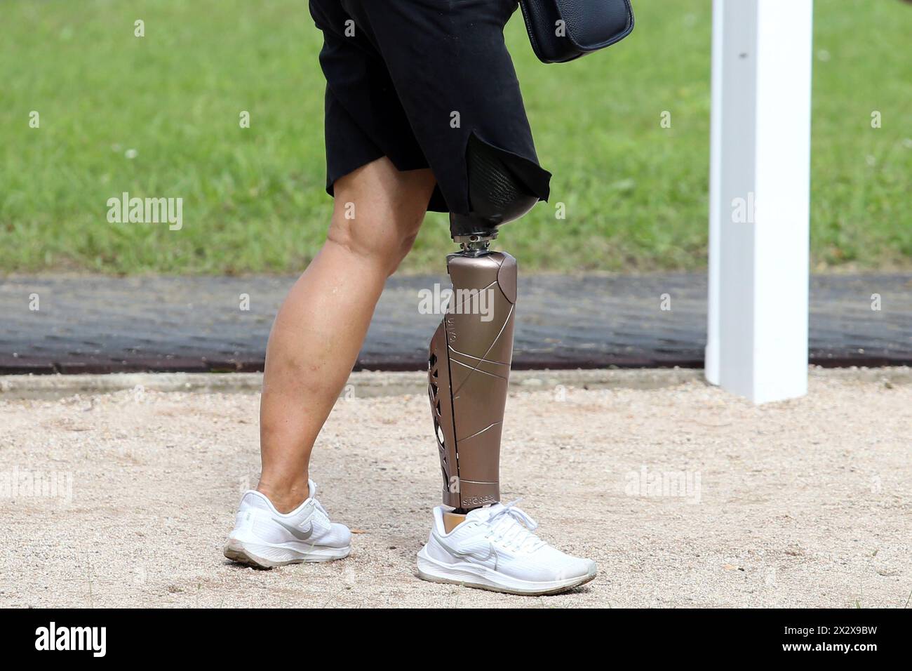 A lower leg prosthesis hi-res stock photography and images - Alamy