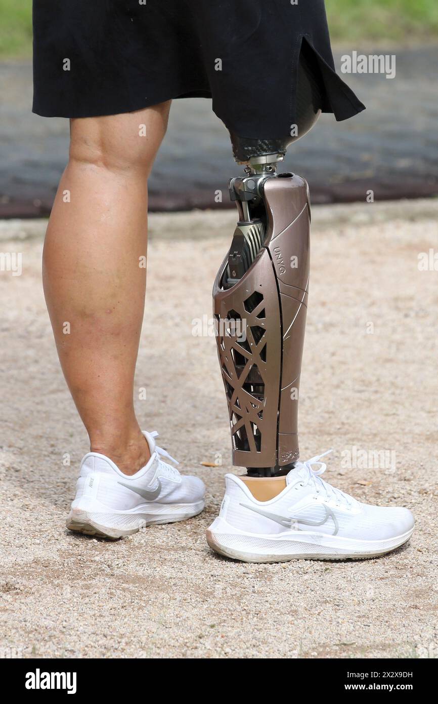 Lower limb prosthesis hi-res stock photography and images - Alamy