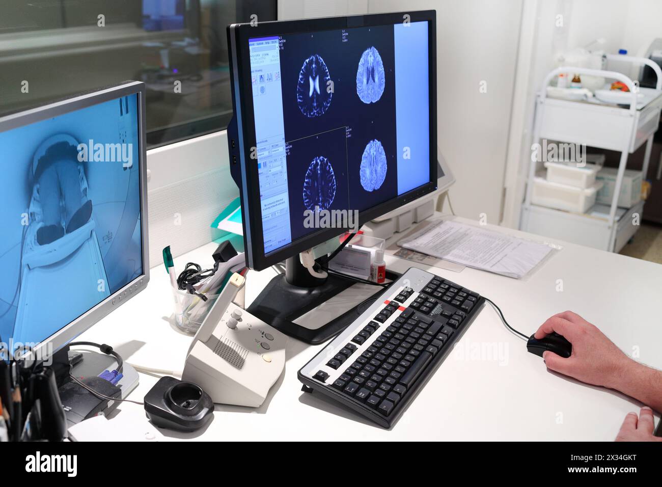Mri scan on computer monitor hi-res stock photography and images - Alamy