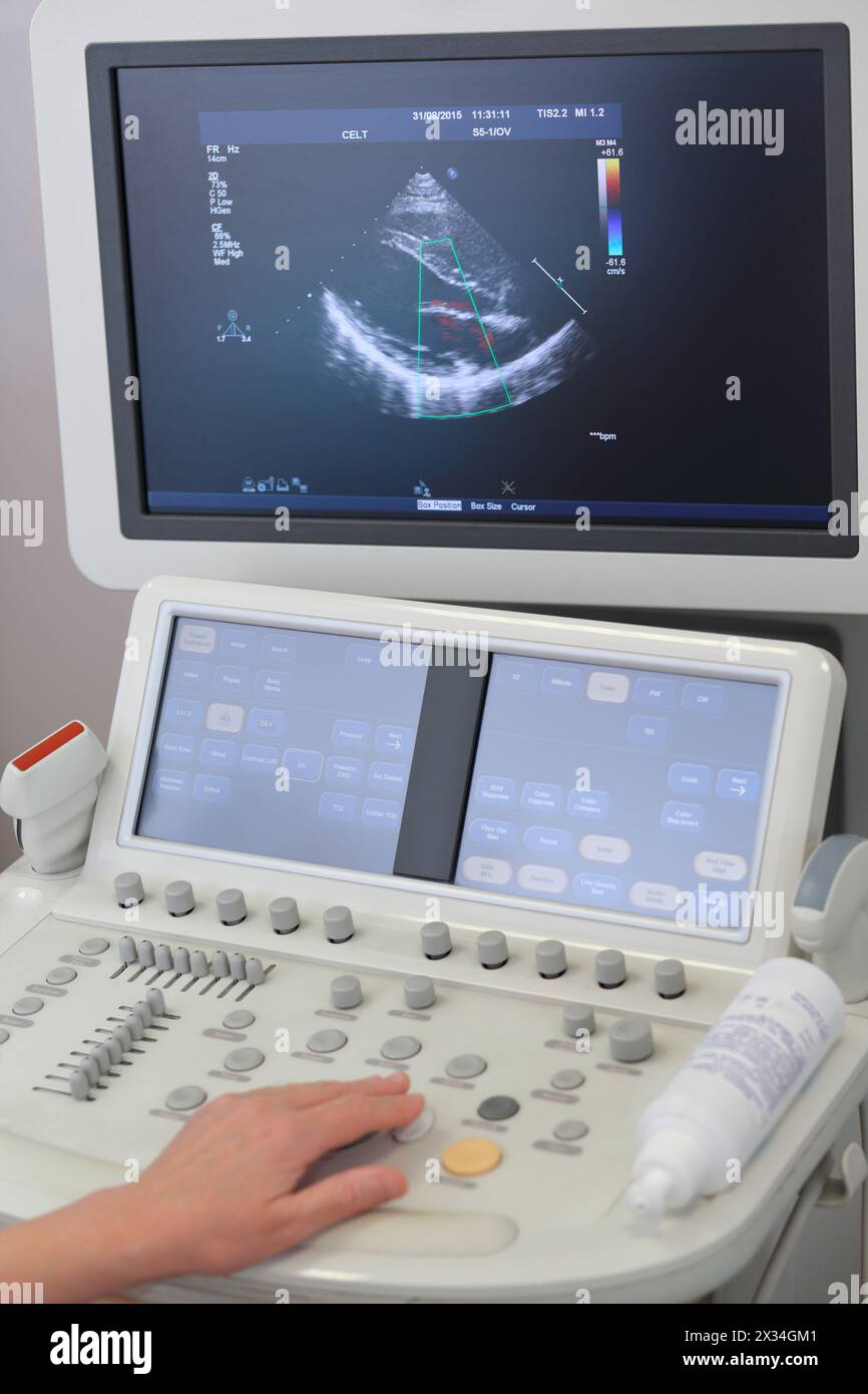 MOSCOW - AUG 31, 2015: Modern ultrasound system, monitor and control ...