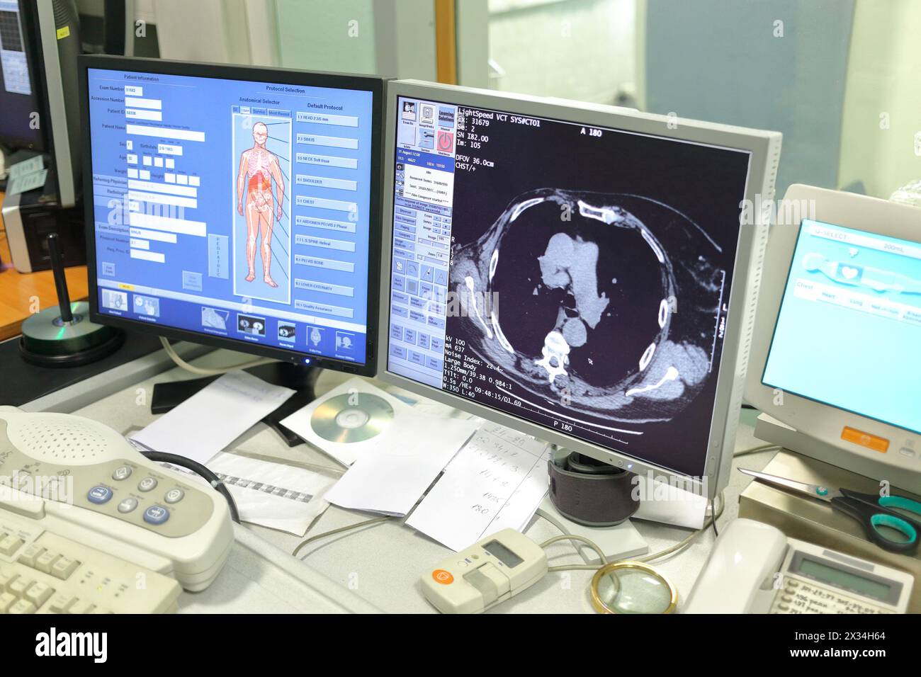 Hospital x ray room monitor screen hi-res stock photography and images ...