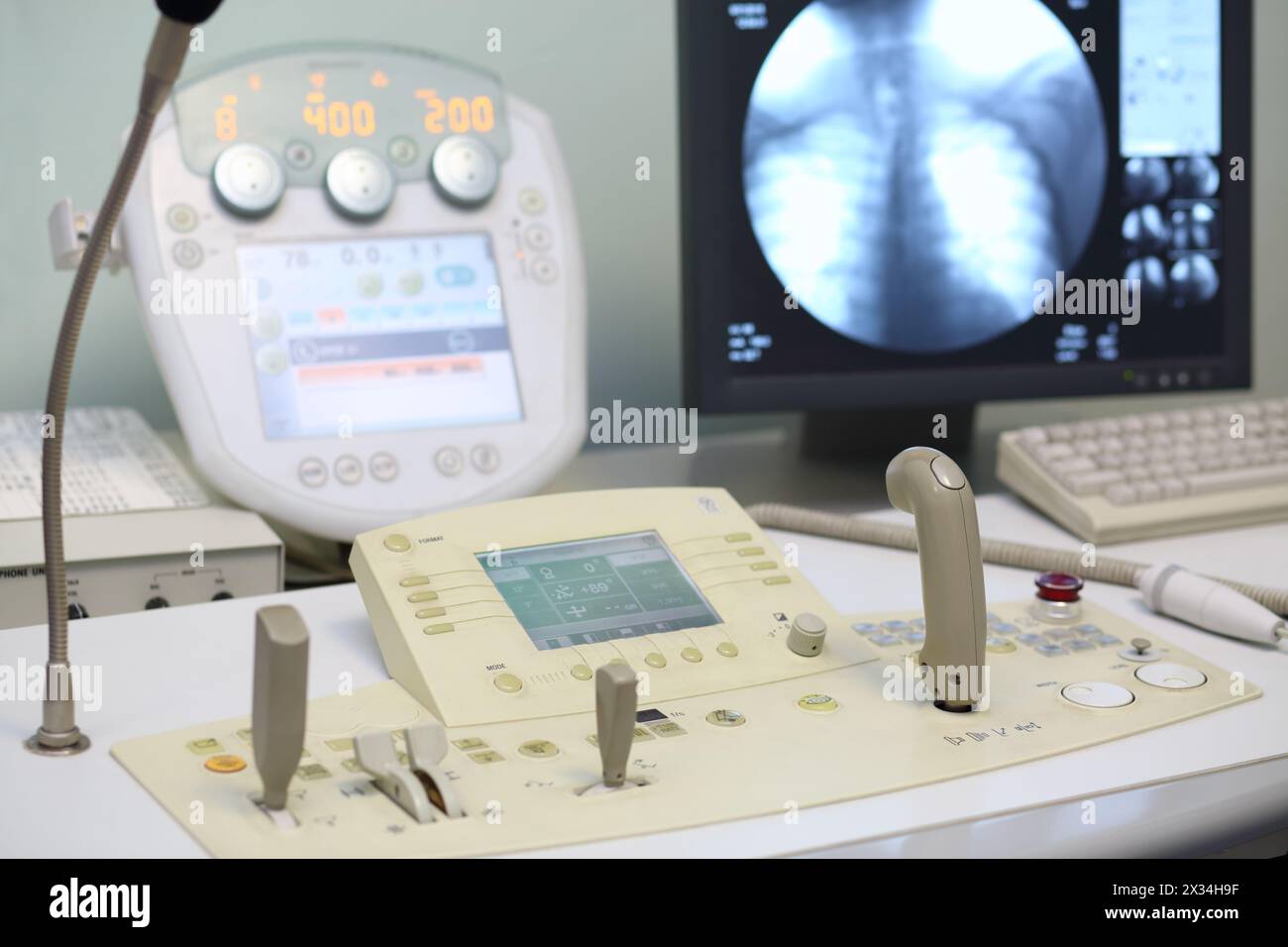 Digital control system and lungs picture on a computer monitor in x-ray ...