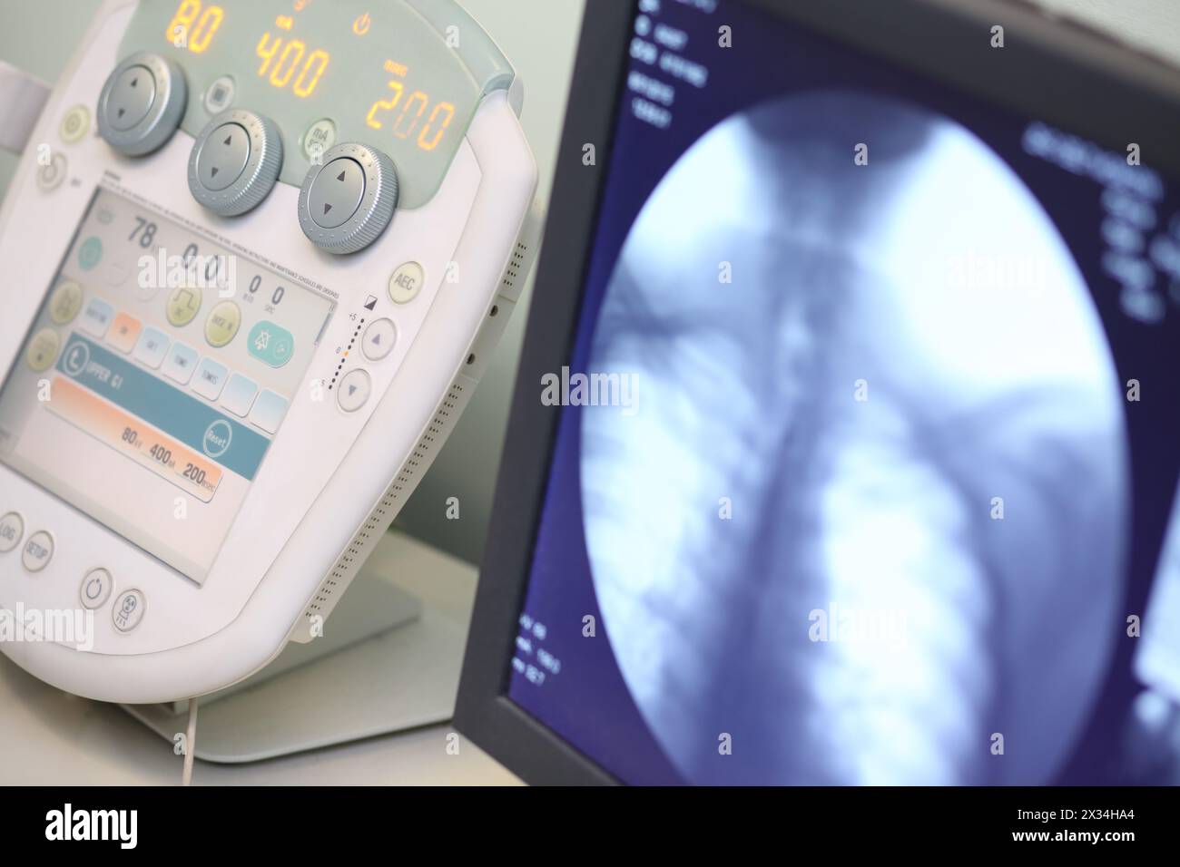 Remote Control and lungs picture on a computer monitor in x-ray cabinet ...