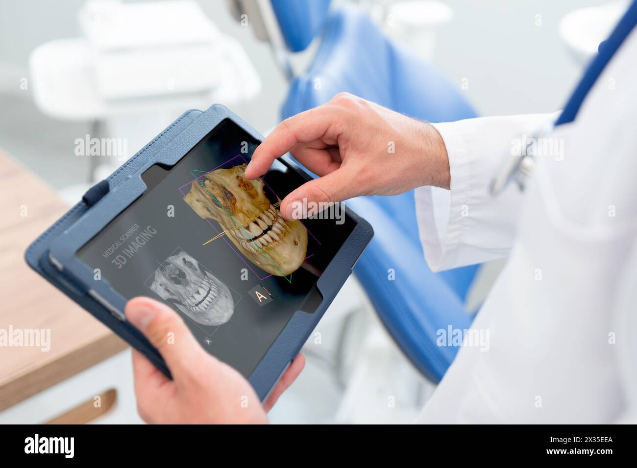 3d scan procedure hi-res stock photography and images - Alamy