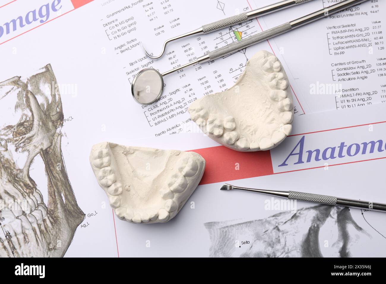 Dental model with gums and dentist tools on anatomy charts, flat lay ...