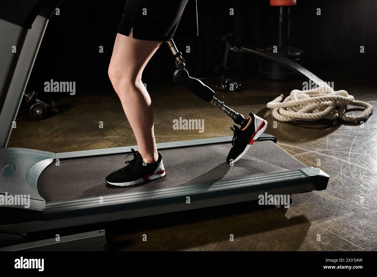 A person with a prosthetic leg is walking on a treadmill in a gym ...