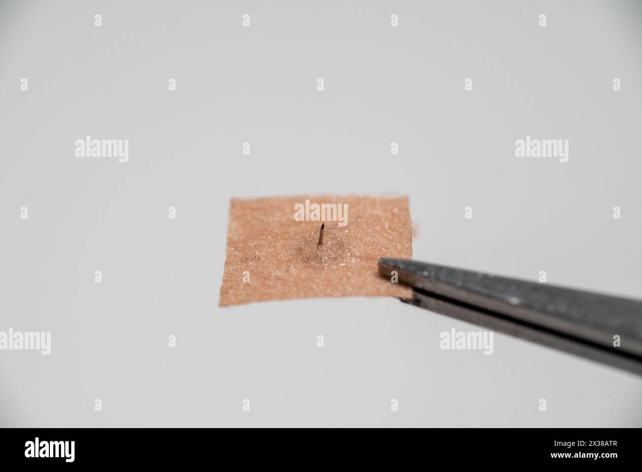 Auriculotherapy (also auricular therapy, ear acupuncture, and ...