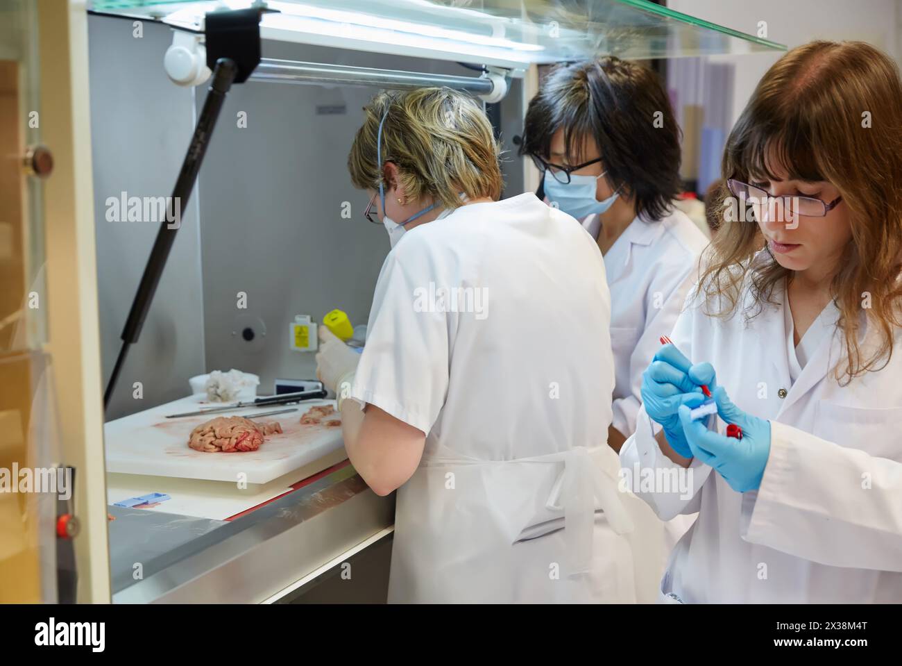Selecting brain tissue sample, Anatomic Pathology, Hospital Donostia ...