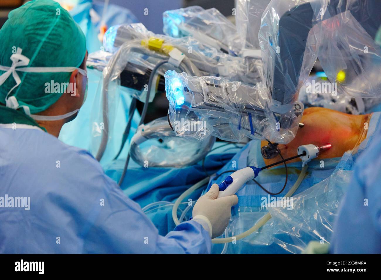 Operating room, Prostate cancer robotic surgery, Da Vinci surgical ...