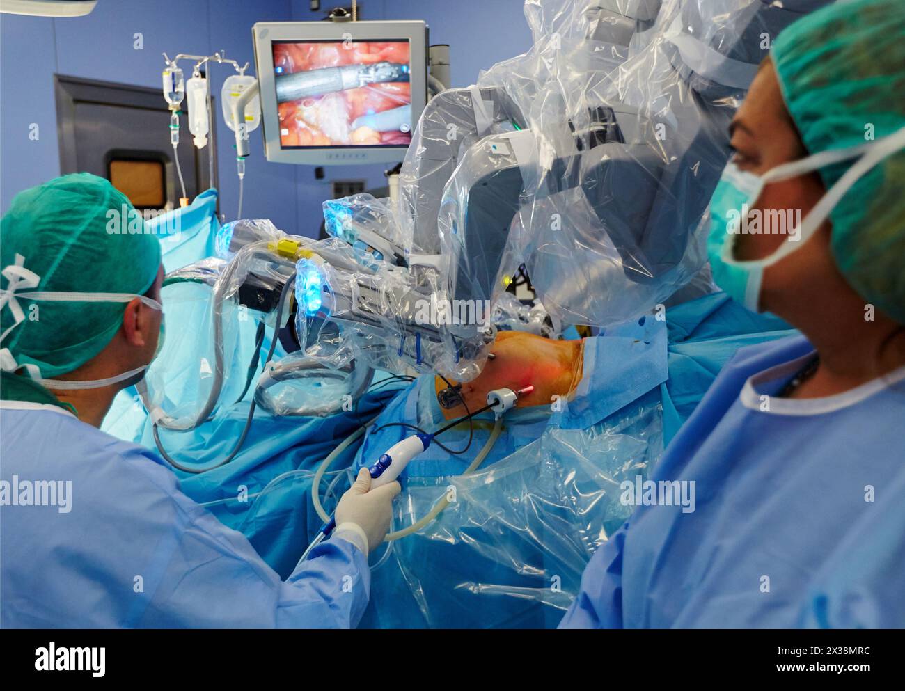 Operating room, Prostate cancer robotic surgery, Da Vinci surgical ...