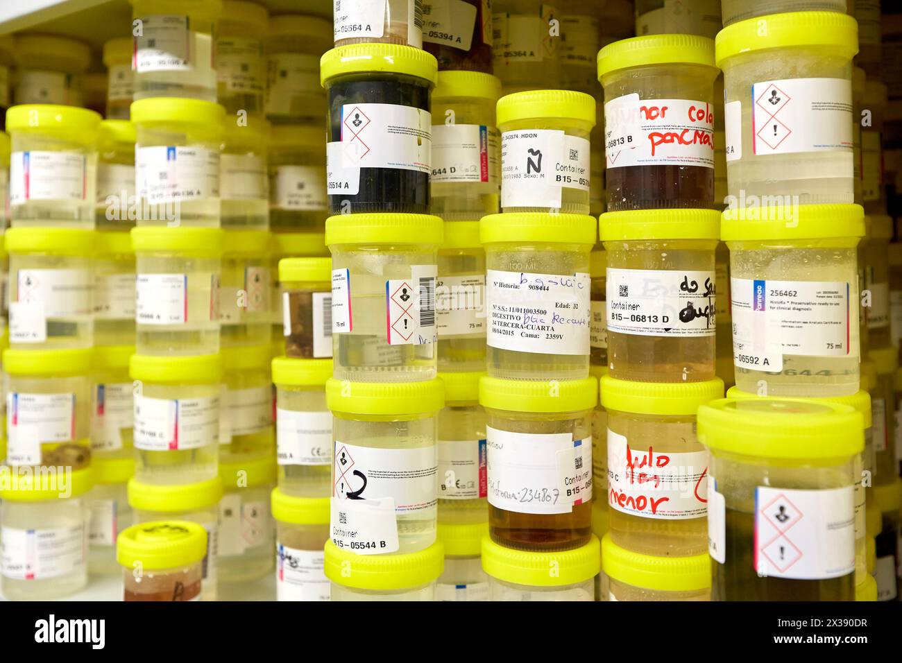 Sample storage, Anatomic Pathology, Hospital Donostia, San Sebastian, Gipuzkoa, Basque Country ...