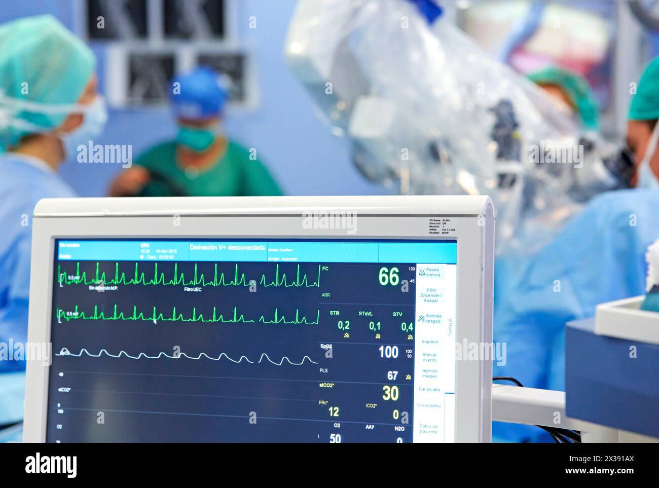 Operating room, Brain operation, Neurosurgery, Hospital Donostia, San ...