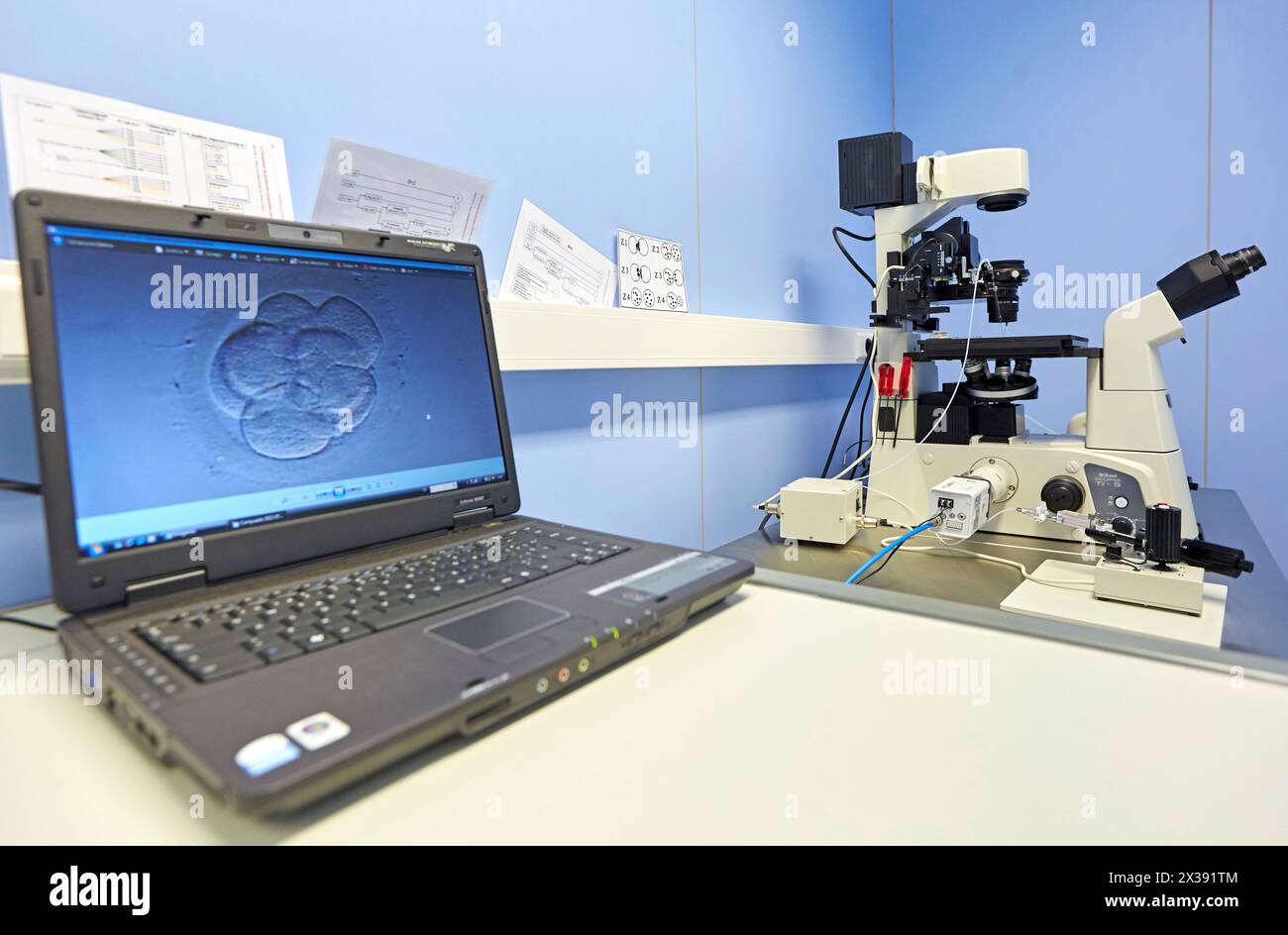 Embryo selection for IVF, URA, ARU, Assisted Reproduction Unit, In ...