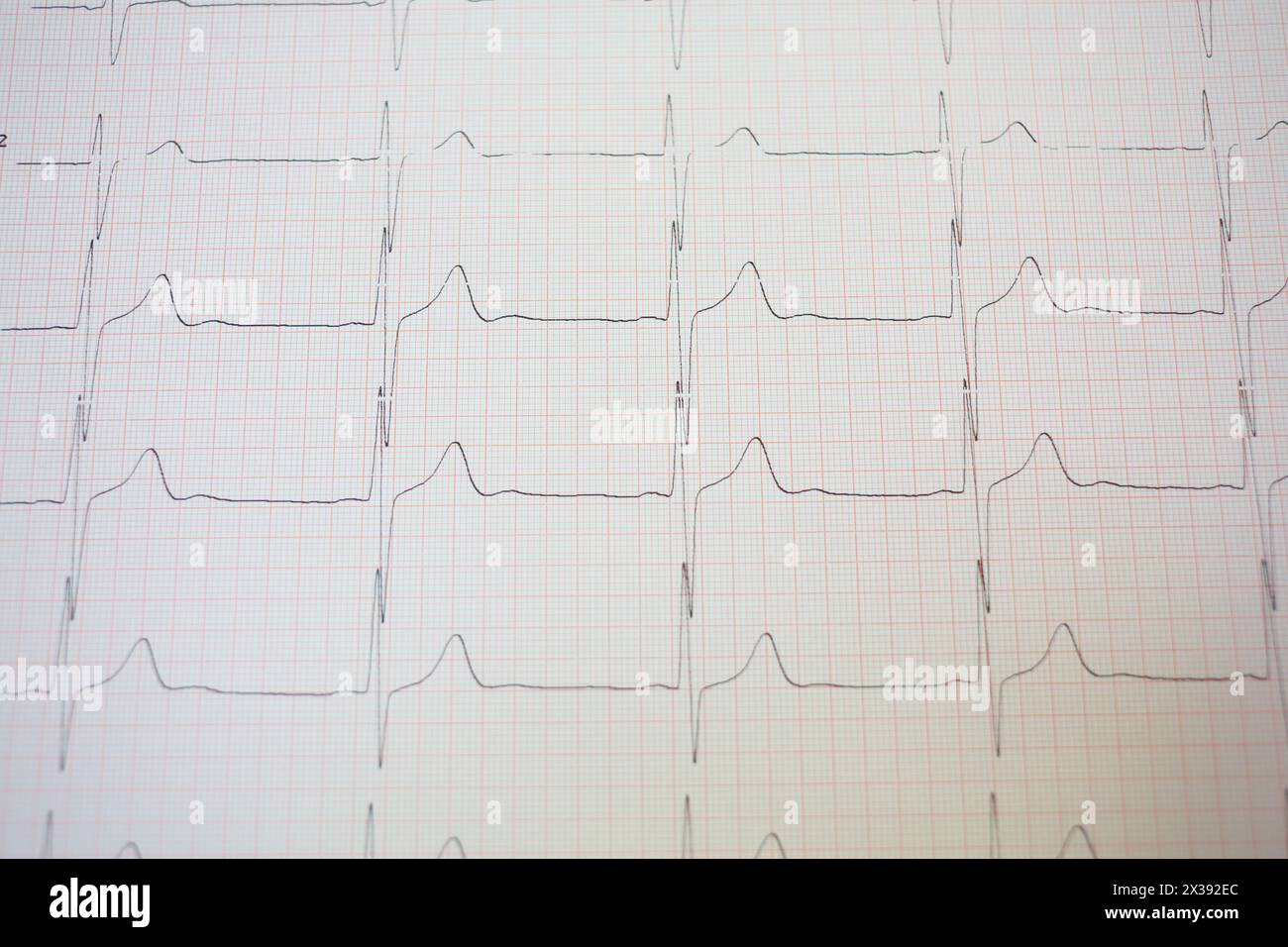 Electrocardiogram in pink paper form in hospital, close up view Stock ...