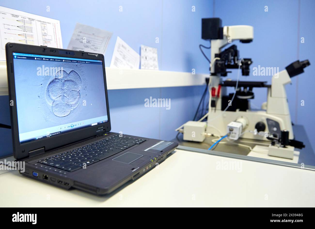 Embryo selection for IVF, URA, ARU, Assisted Reproduction Unit, In ...