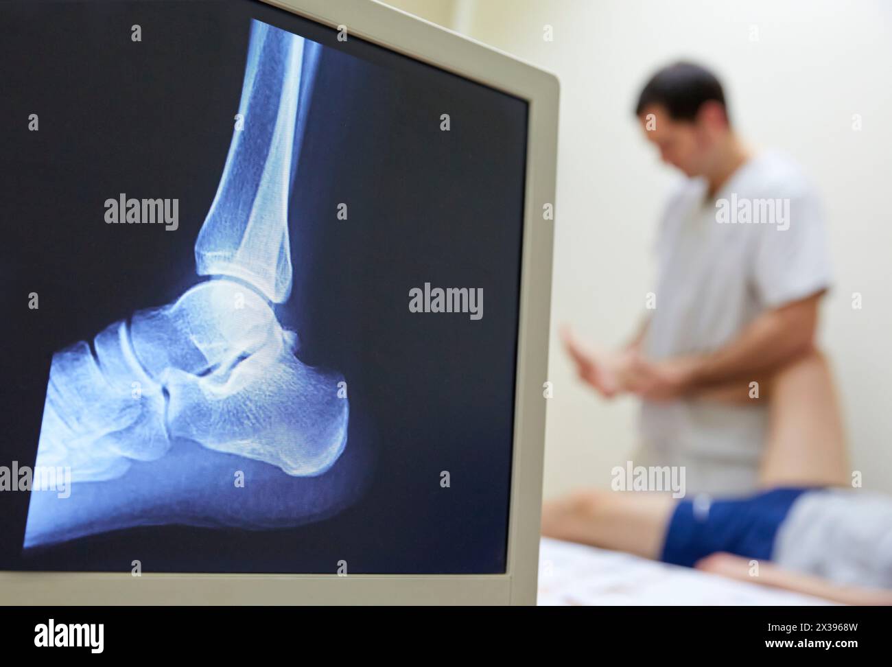 Mobilization passive inversion of the ankle, ankle X-ray image ...