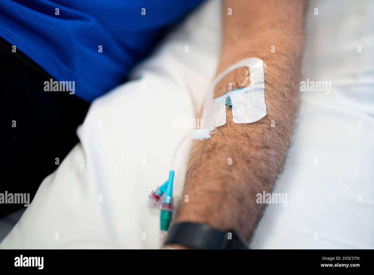 The needle used to administer infusion to patient Steve Young, having ...