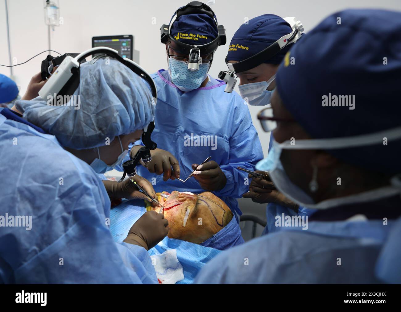 IVANO-FRANKIVSK, UKRAINE - APRIL 25, 2024 - Surgeons of the Face the ...