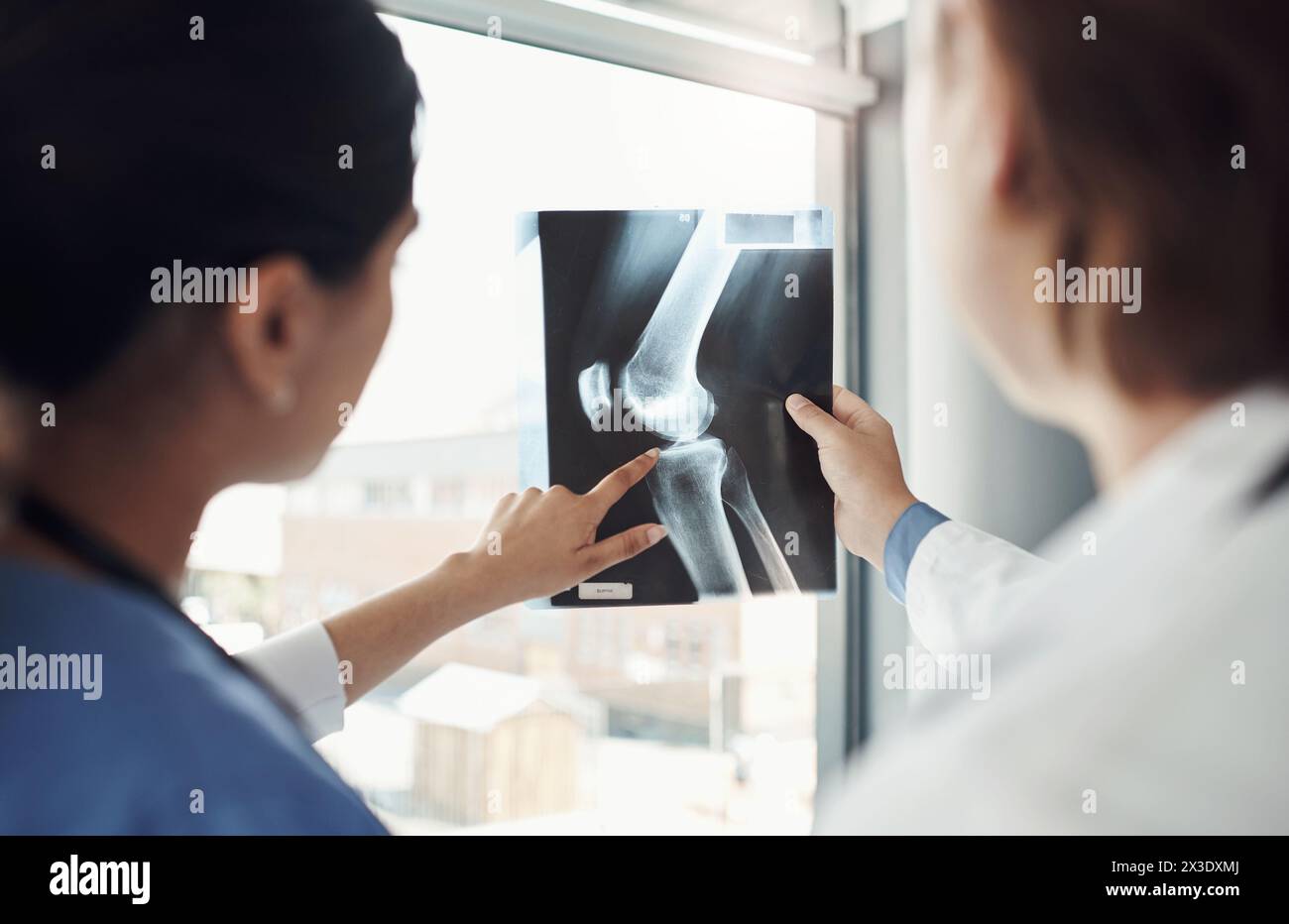 Doctor, nurse and xray in radiology for bones in patient with ...