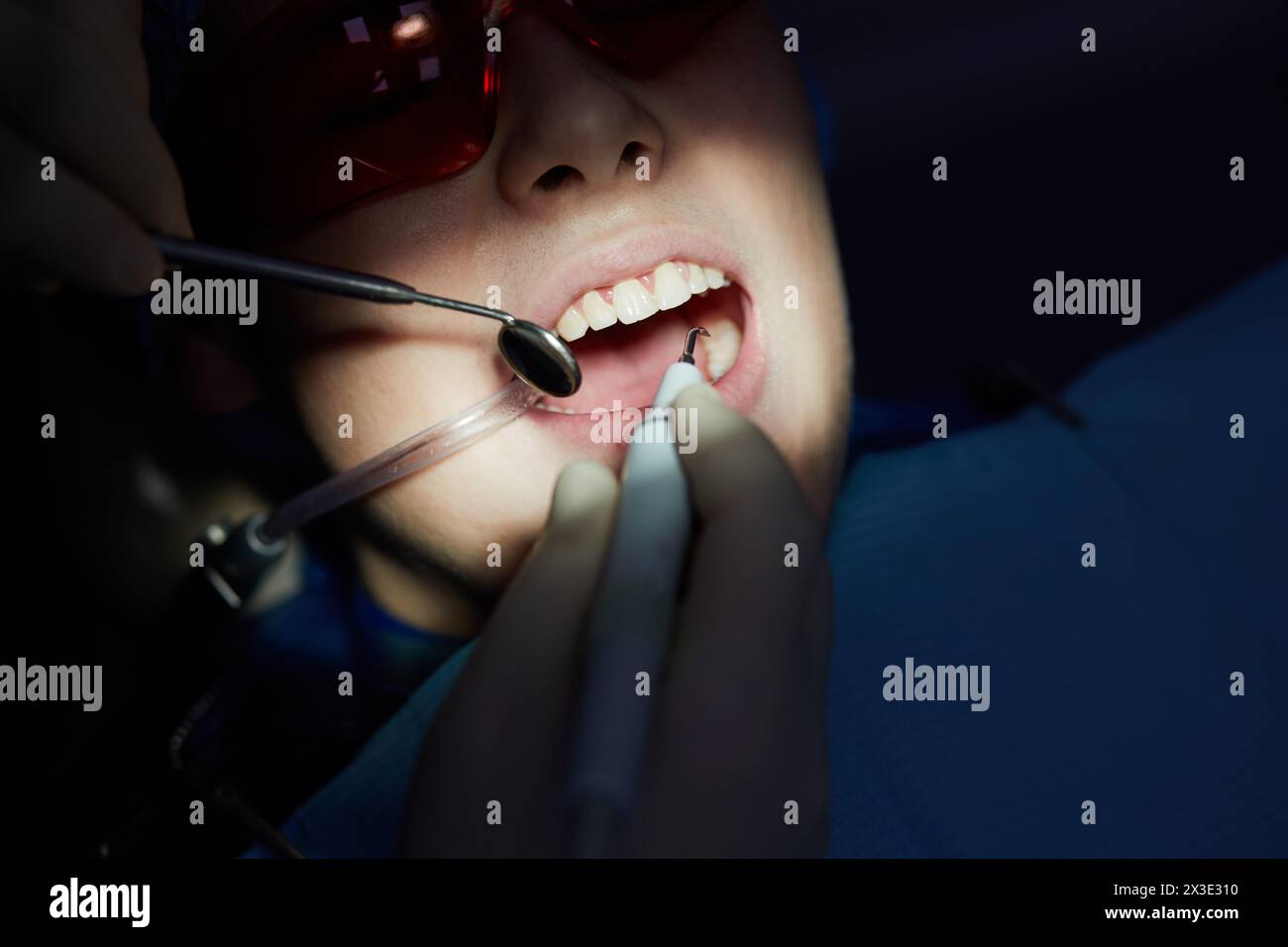 Dentist makes ultrasonic teeth cleaning to boy using special tools in ...