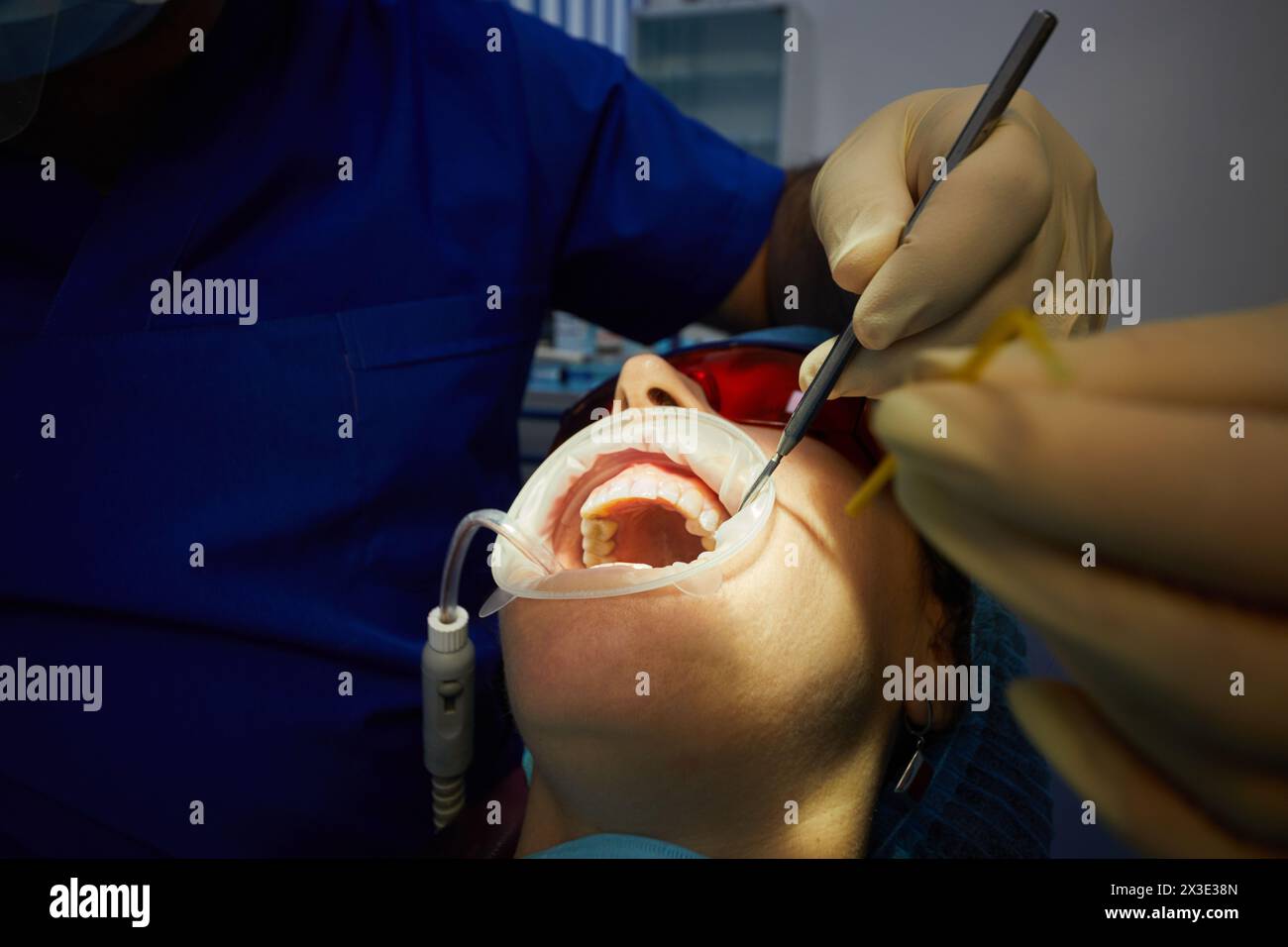 Close-up open mouth of woman patient on dentist chair and hands of ...