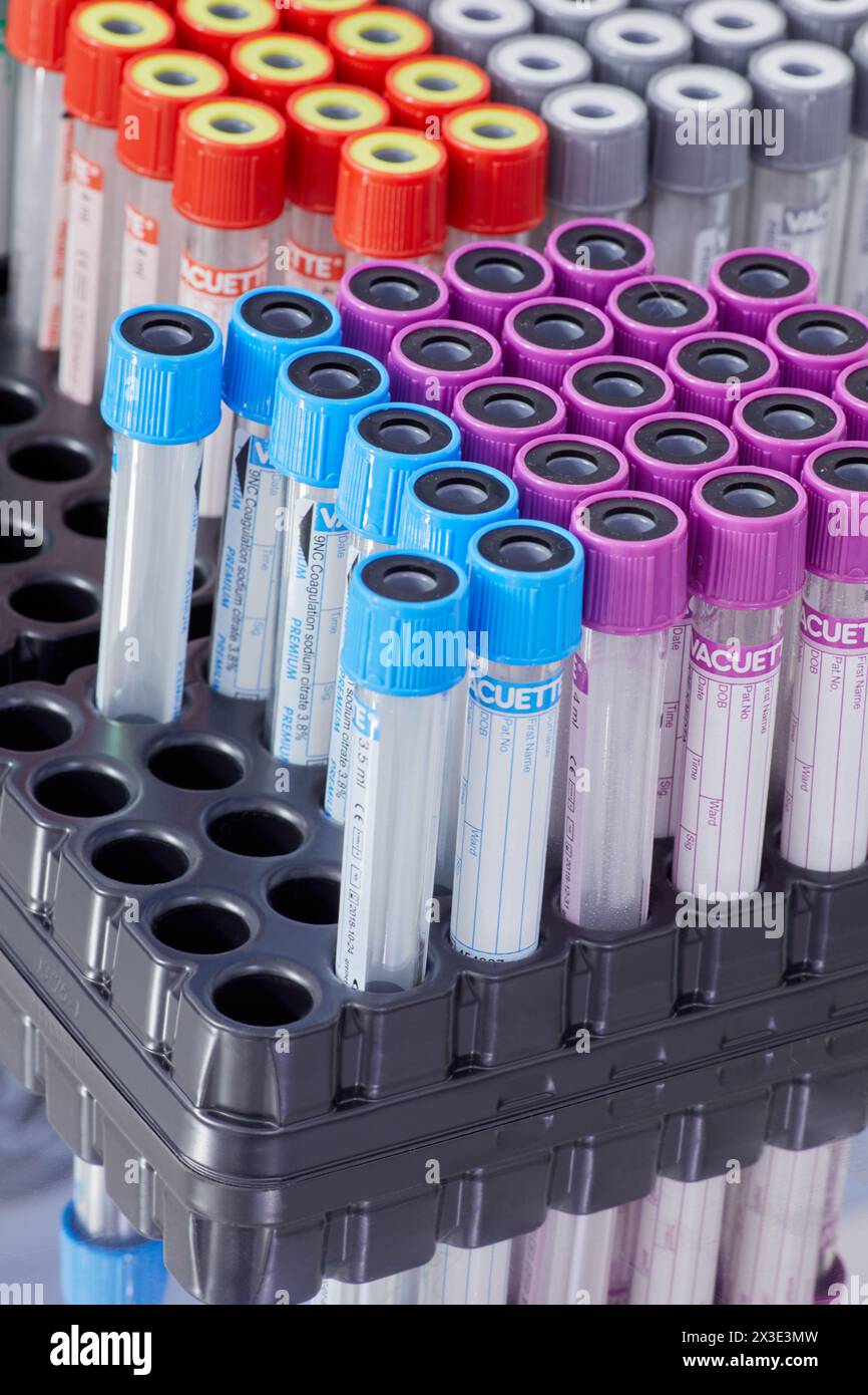 MOSCOW, RUSSIA - DEC 13, 2017: Vacuum VACUETTE test tubes for taking ...