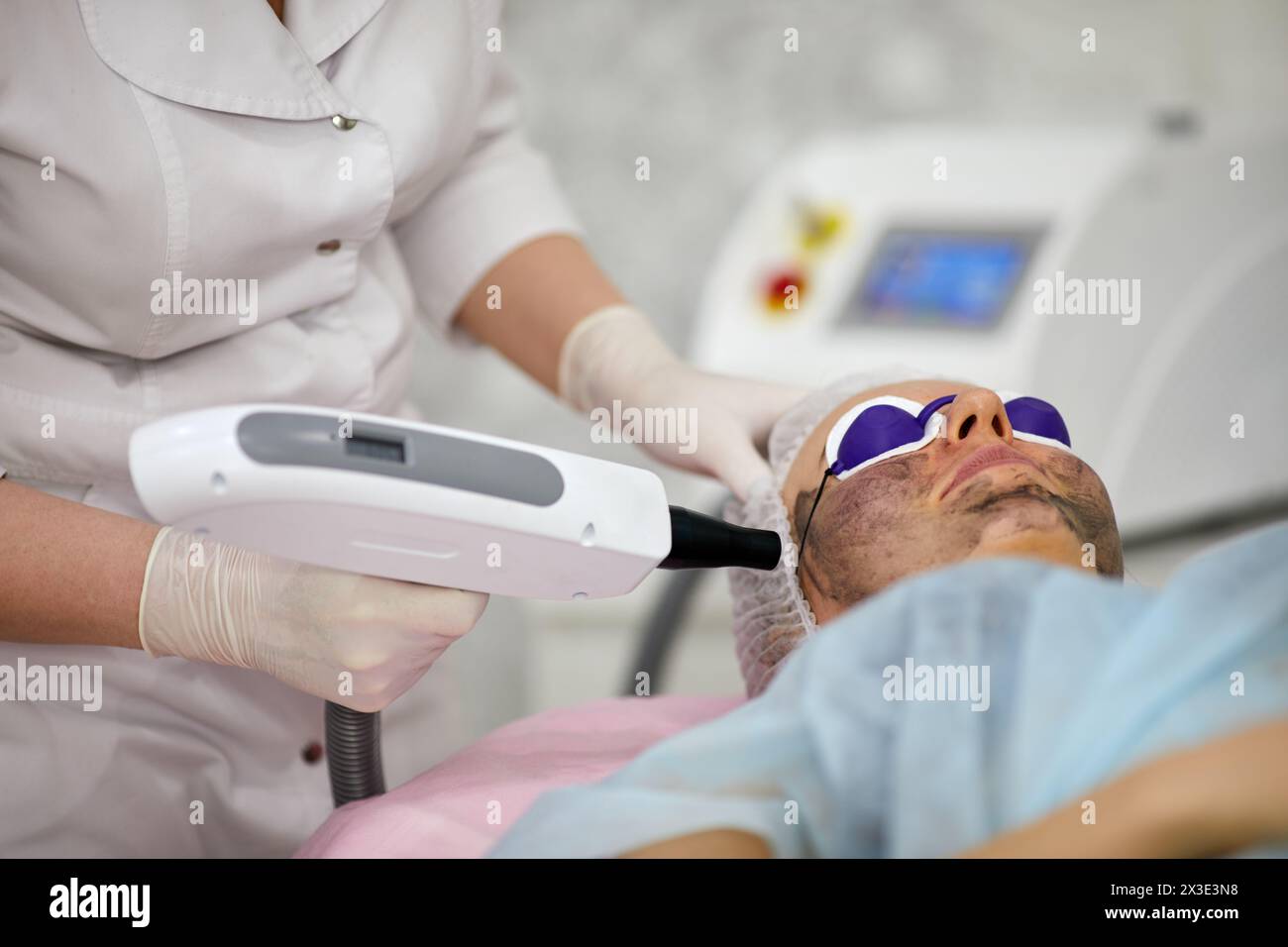 Cosmetician uses laser for epilate patient face in cosmetology office ...