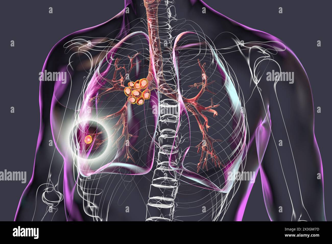 Highlighting anatomical structures hi-res stock photography and images ...