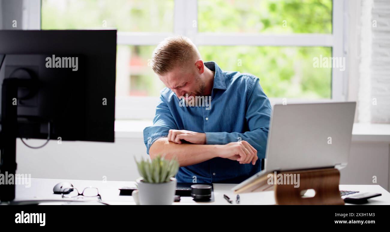 Man With Itchy Skin. Allergy Or Psoriasis Stock Photo - Alamy