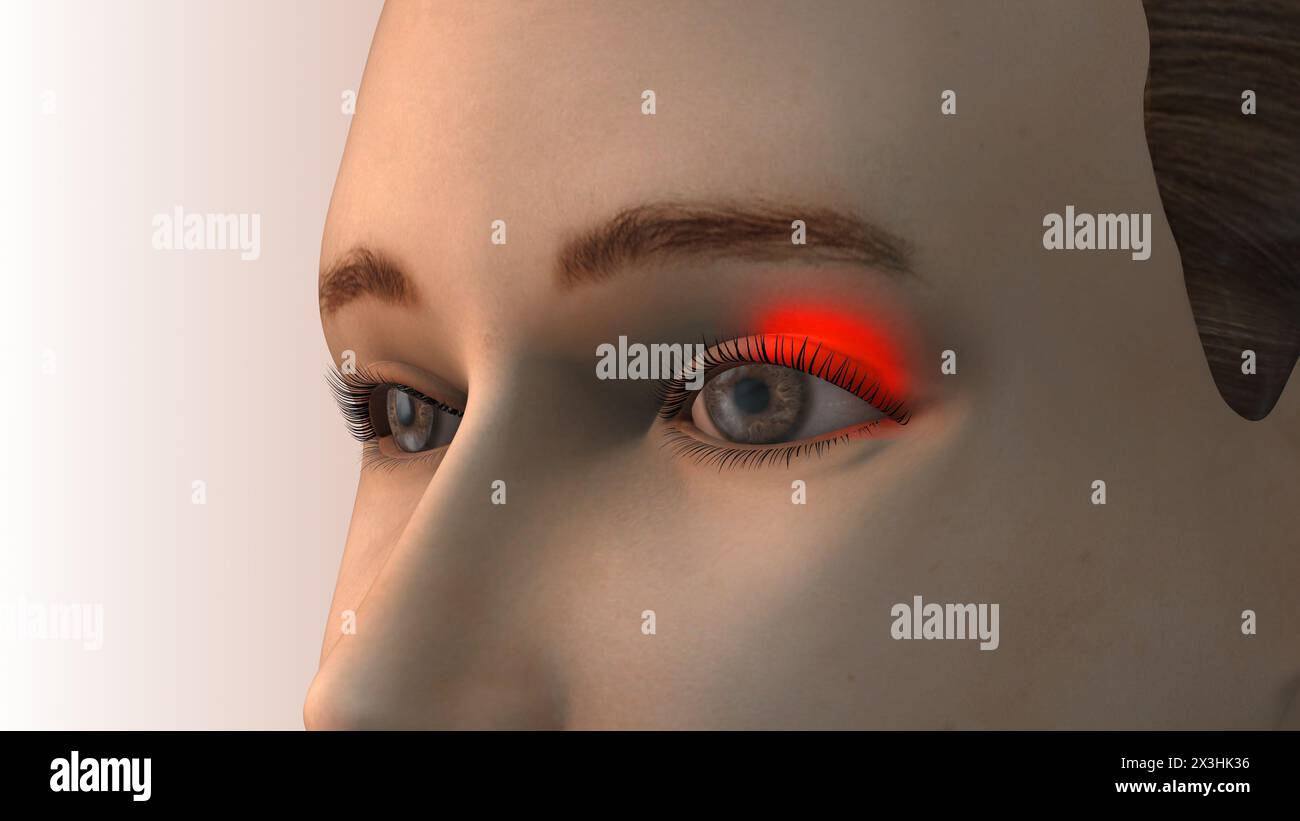 Eyelid edge hi-res stock photography and images - Alamy