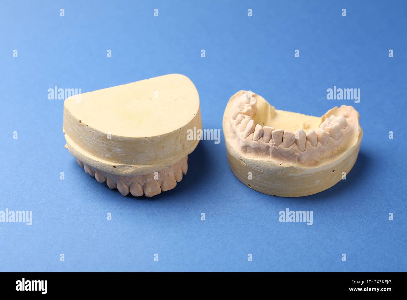 Dental model with gums on blue background. Cast of teeth Stock Photo ...