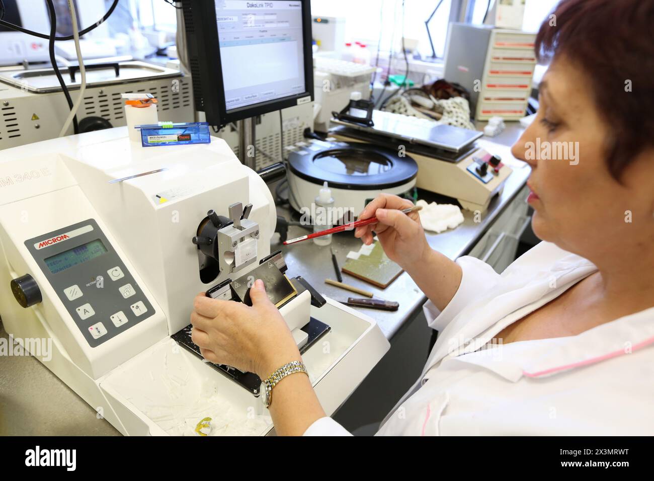 Histology, Microtome, Anatomic Pathology, Onkologikoa Hospital, Oncology Institute, Case Center ...